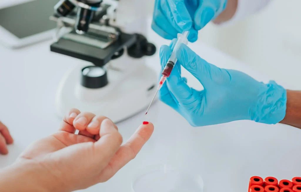 What Is a UEC Blood Test? Get Referral Online Fast